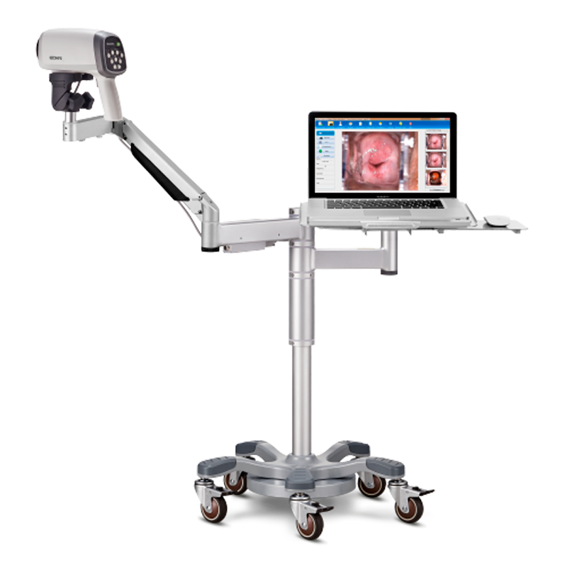 Videocolposcopio HD C6A iluminación LED brillante en frío